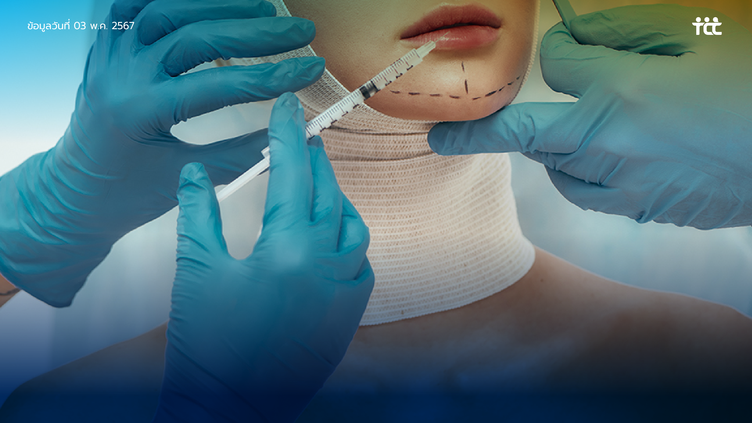 ยื่น 4 ข้อเสนอ ยกระดับการคุ้มครองผู้บริโภคด้านบริการเสริมความงาม - สภา ...